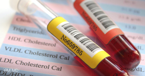 Your Lipid Panel Blood Test: What Your Doctor Isn’t Telling You – AMMD