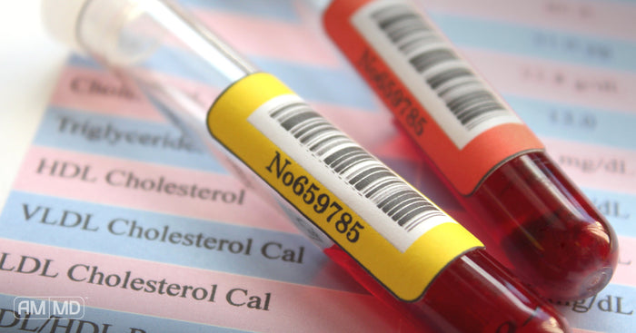Your Lipid Panel Blood Test: What Your Doctor Isn’t Telling You – AMMD