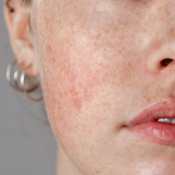 SIBO Support – Amy Myers MD